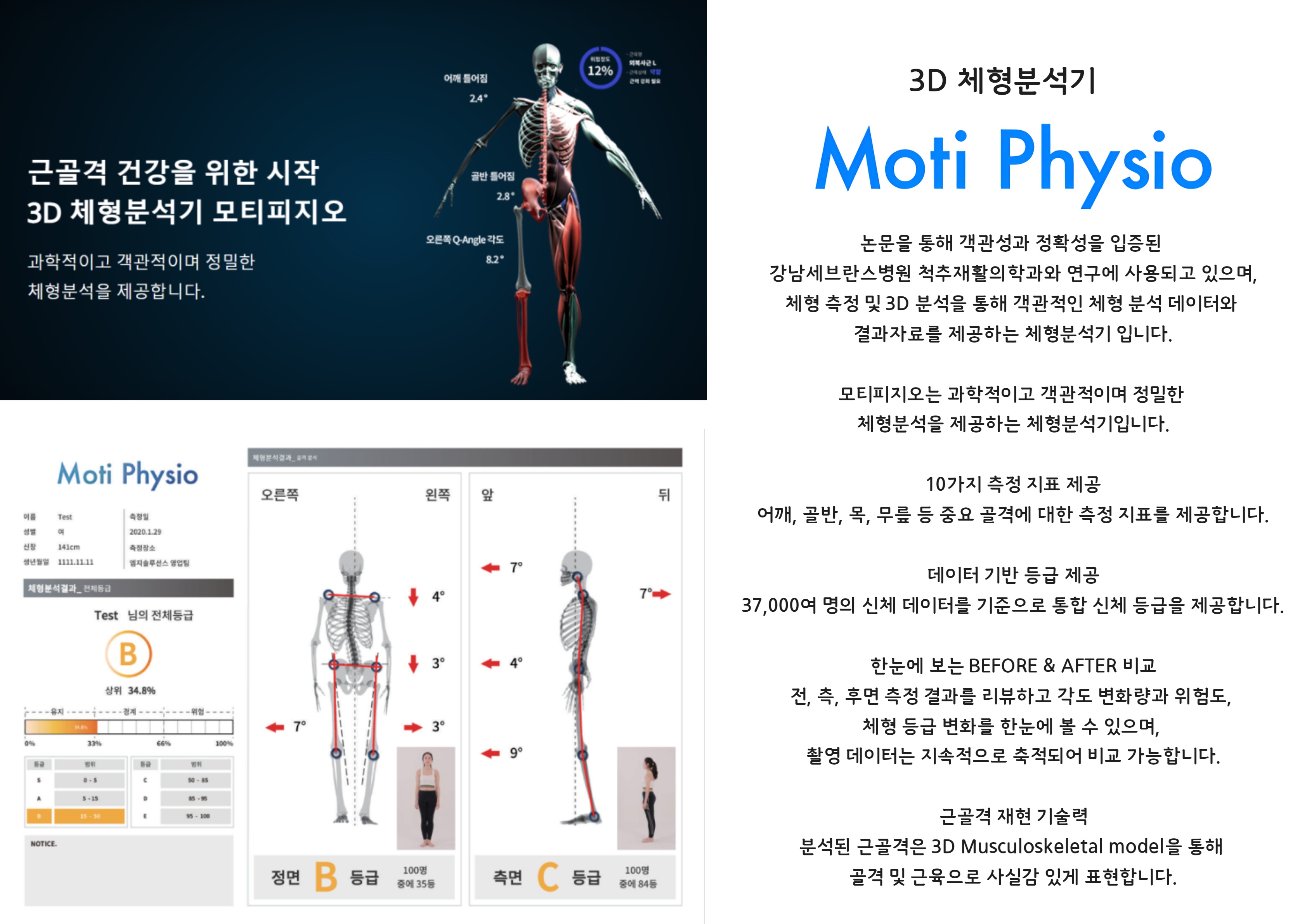 전문 의료진들이 인정한 3d 체형분석기 모티피지오 도입 경기도 남양주시 다산동 필라테스요가발레클래스 당근 비즈 소식
